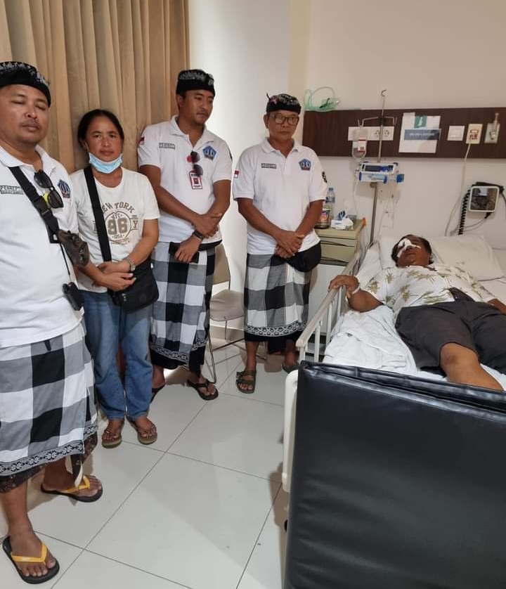 Parah, Turis Arab-AS Hajar Pecalang Hingga 2 Giginya Lepas - Bali Politika